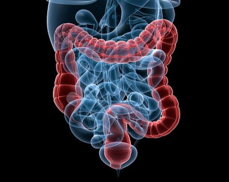 Strumenti specialistici per proctologia anoscopio monuoso, rettoscopio ...